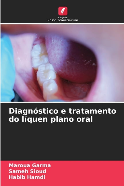 DiagnÃ³stico e tratamento do lÃ­quen plano oral, (Paperback) - Walmart.com