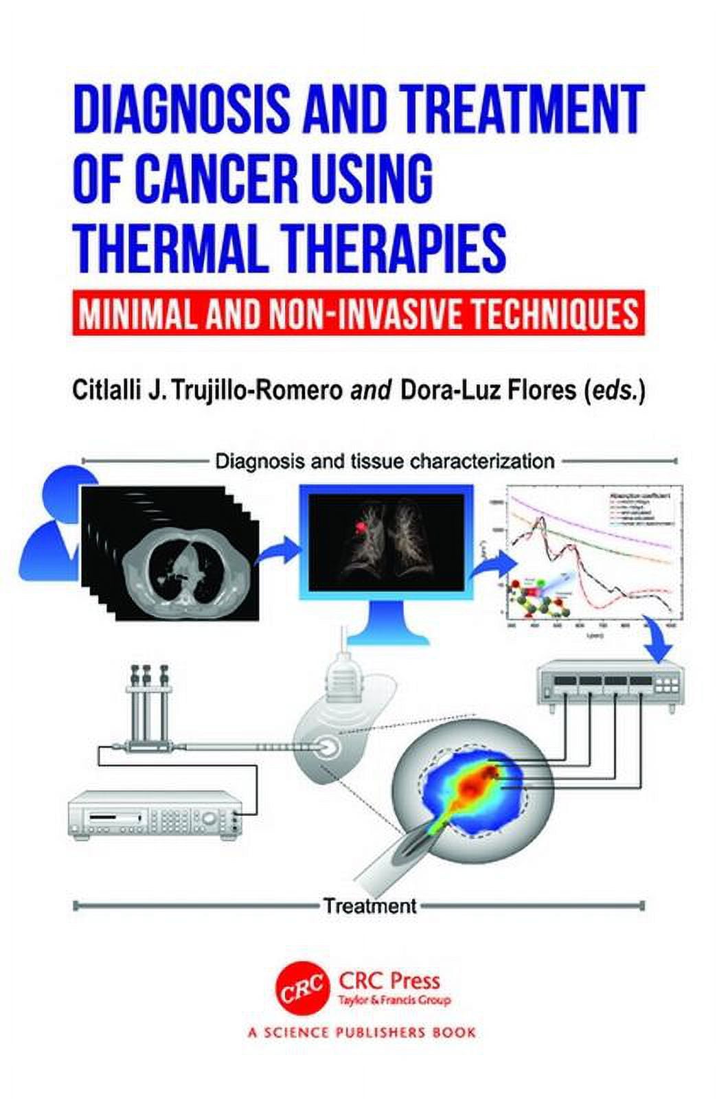 Diagnosis and Treatment of Cancer using Thermal Therapies: Minimal and ...