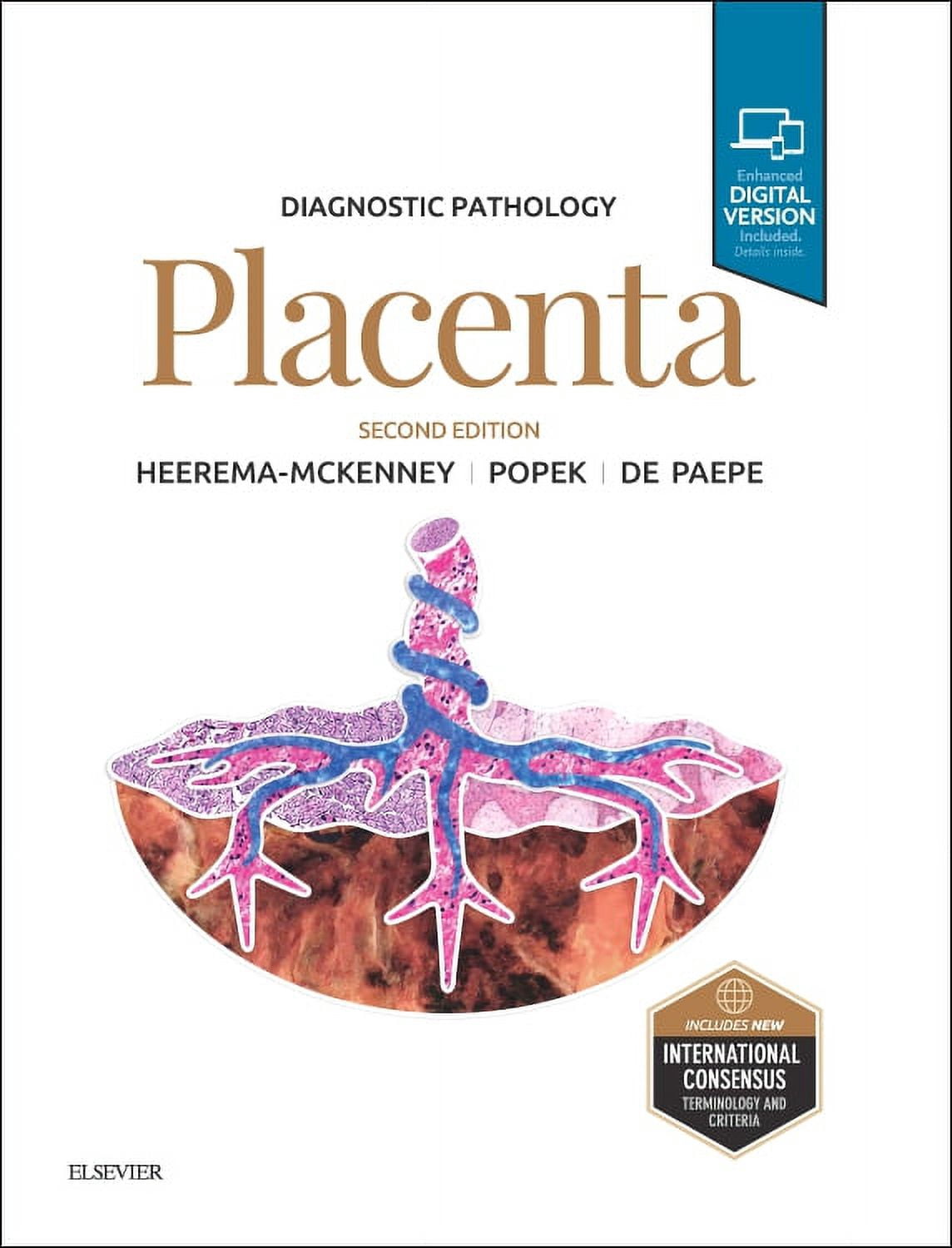 Diagnostic Pathology: Placenta (Hardcover) by Amy Heerema-McKenney ...