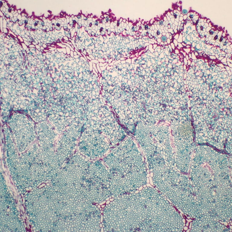 Spongy Mesophyll Slide