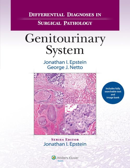 Pre-Owned Differential Diagnoses in Surgical Pathology: Genitourinary ...