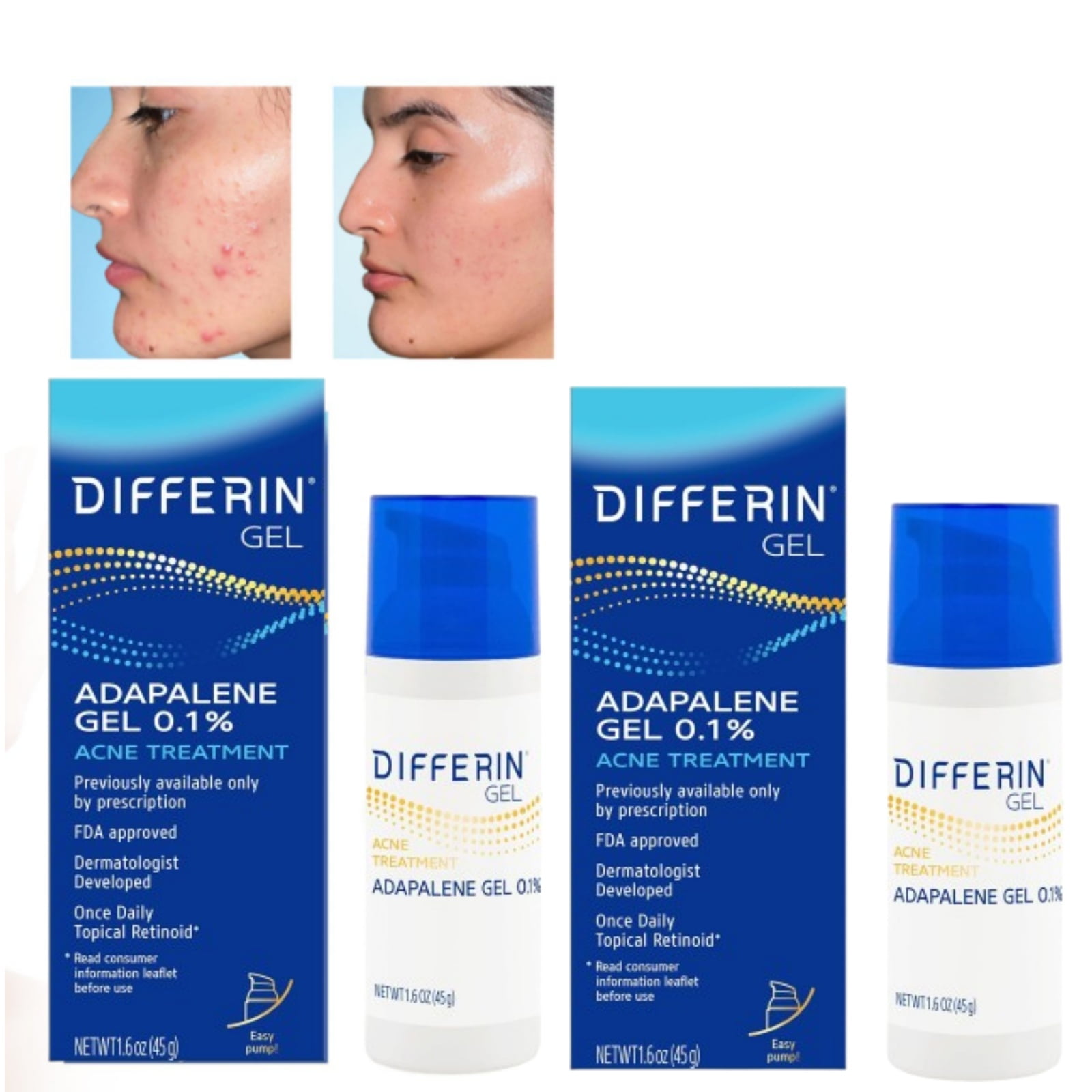 Differin Acne Treatment Gel,90 Day Supply, Retinoid Treatment for Face with 0.1% Adapalene ...