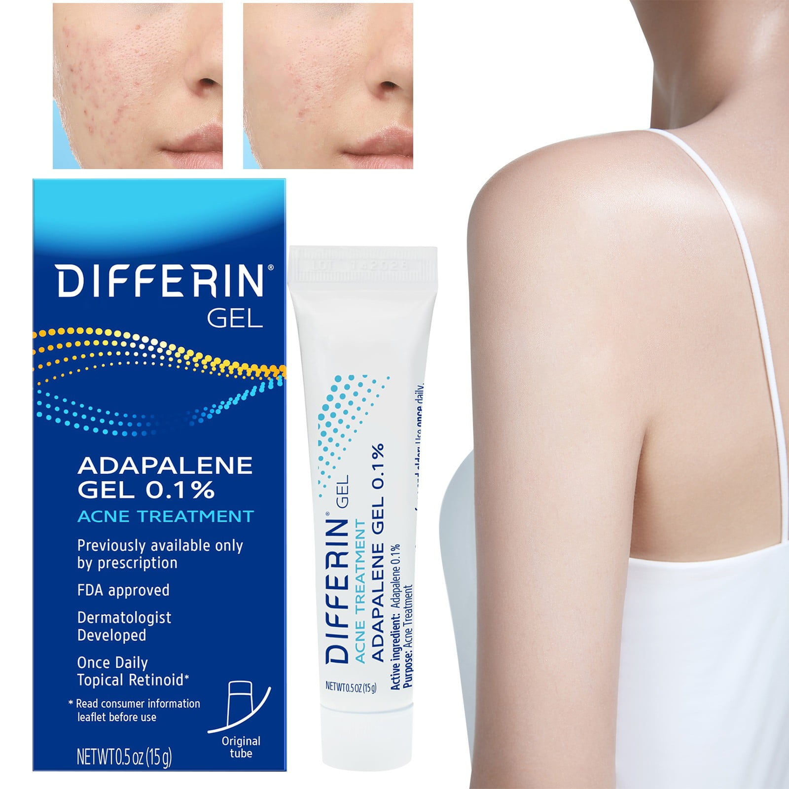 Differin Gel Acne Treatment with Retinoid and 0.1% Adapalene, 0.5oz ...