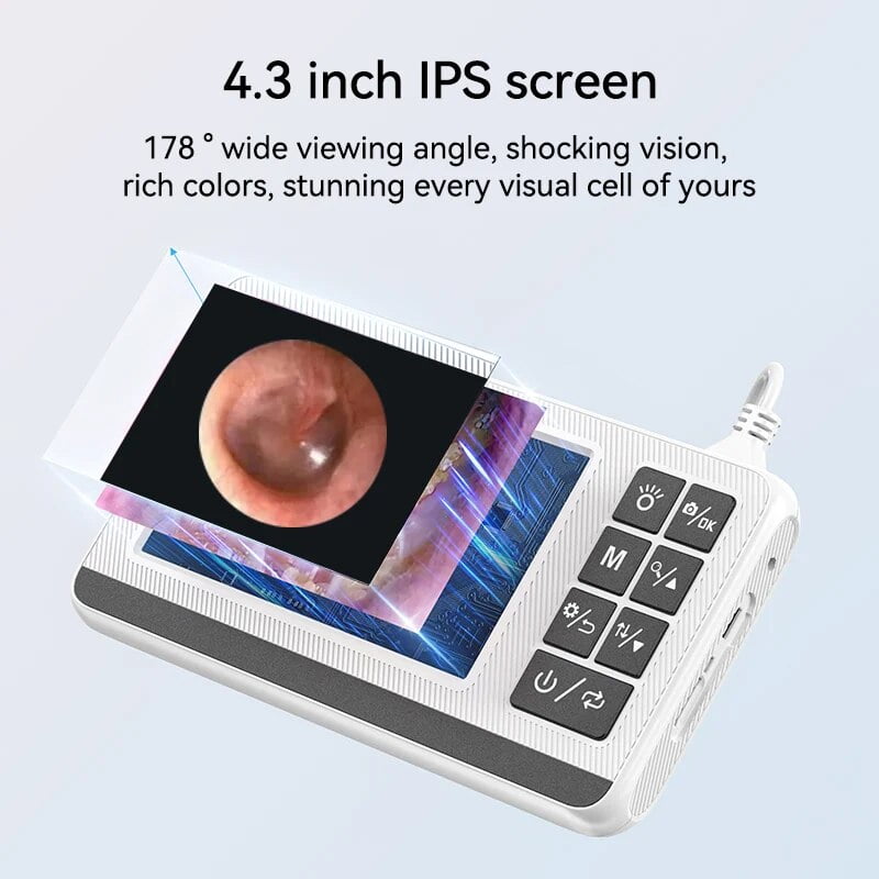 Digital Otoscope Camera Ear Camera With 4.3 Inch IPS Screen Ultra Clear ...