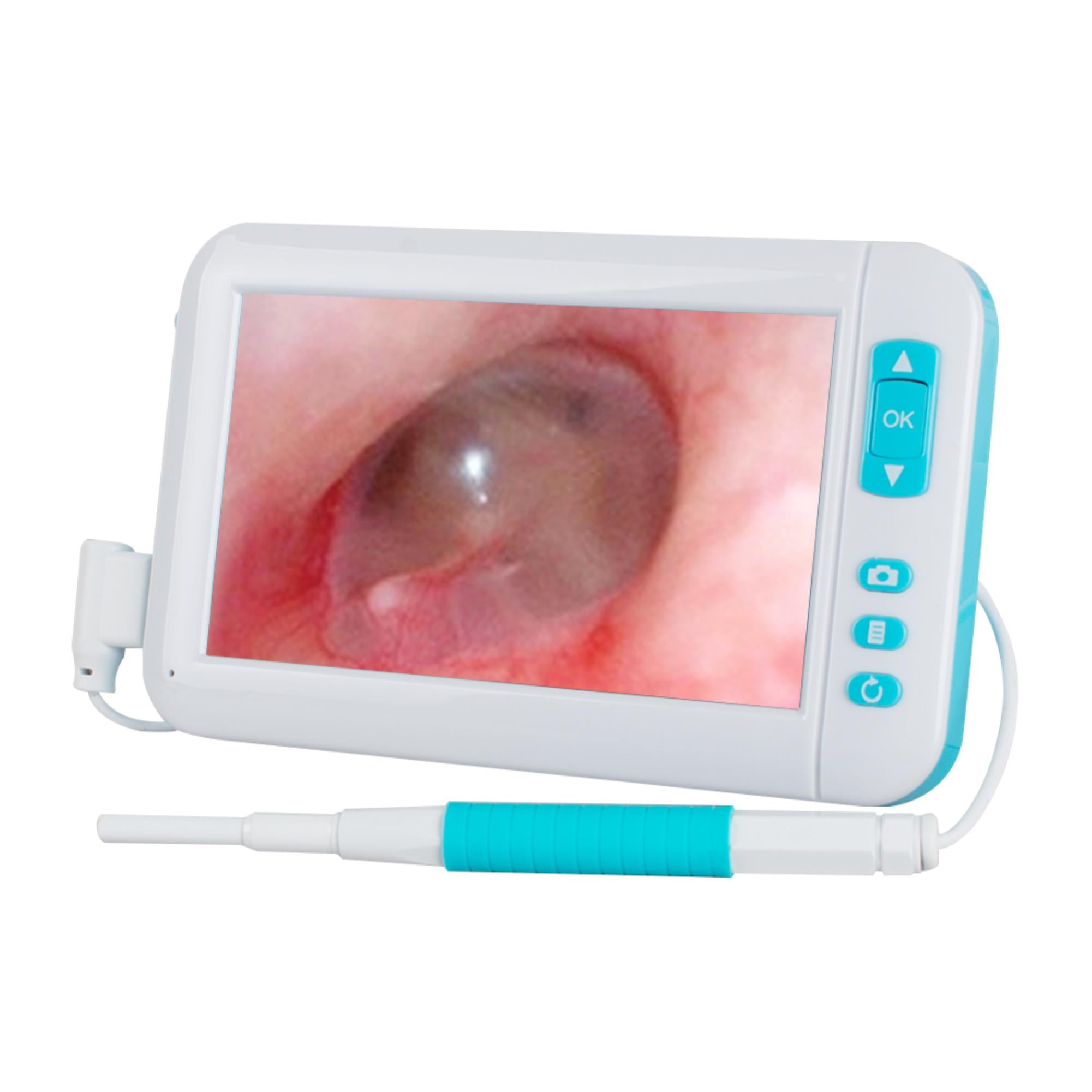 Digital Otoscope Ear Inspection Camera - 4.3 Screen, 6 Lights ...