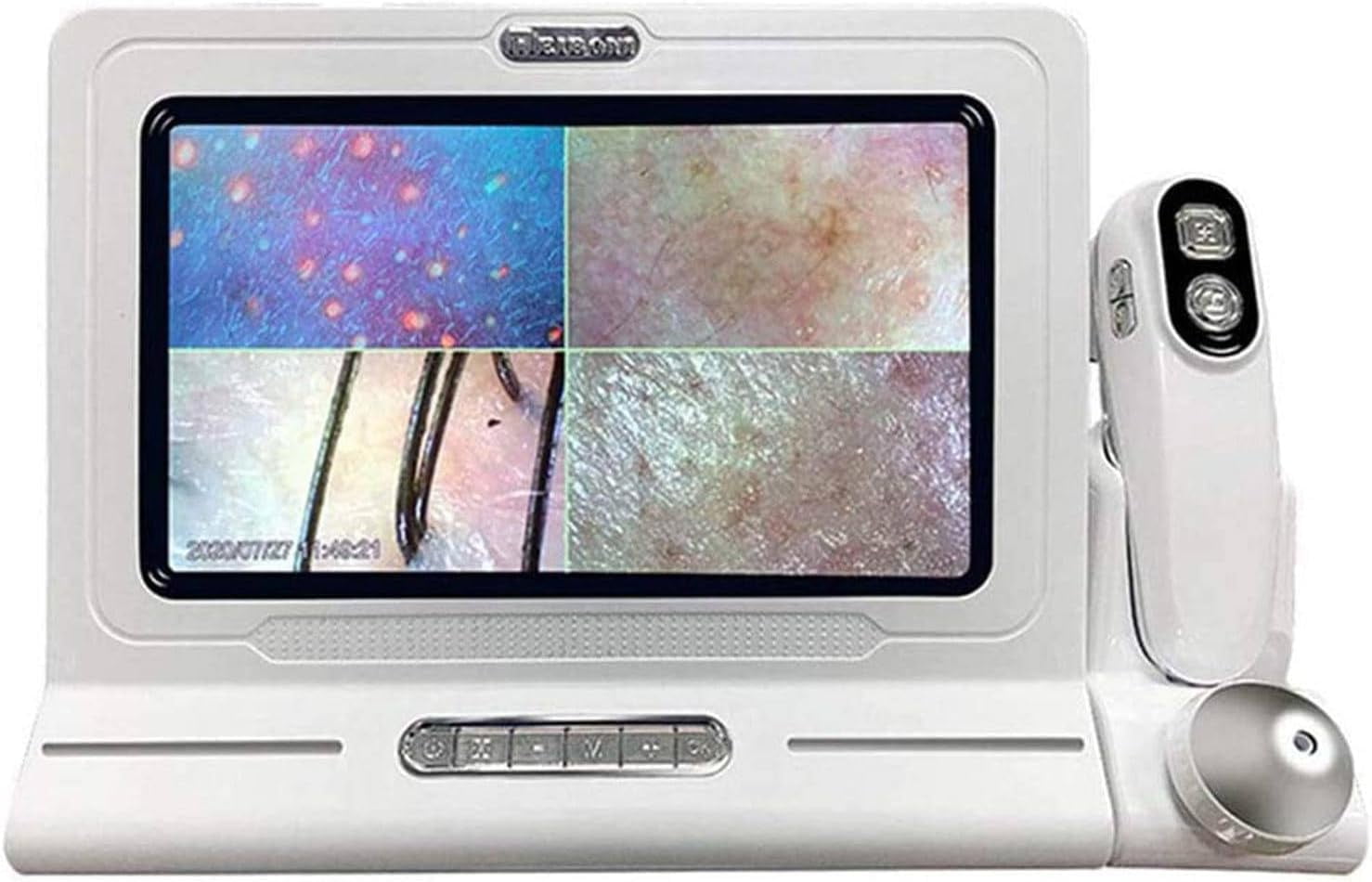 Digital Skin Analyzer,Scalp Hair Follicle Detector, Skin Hair Scalp ...