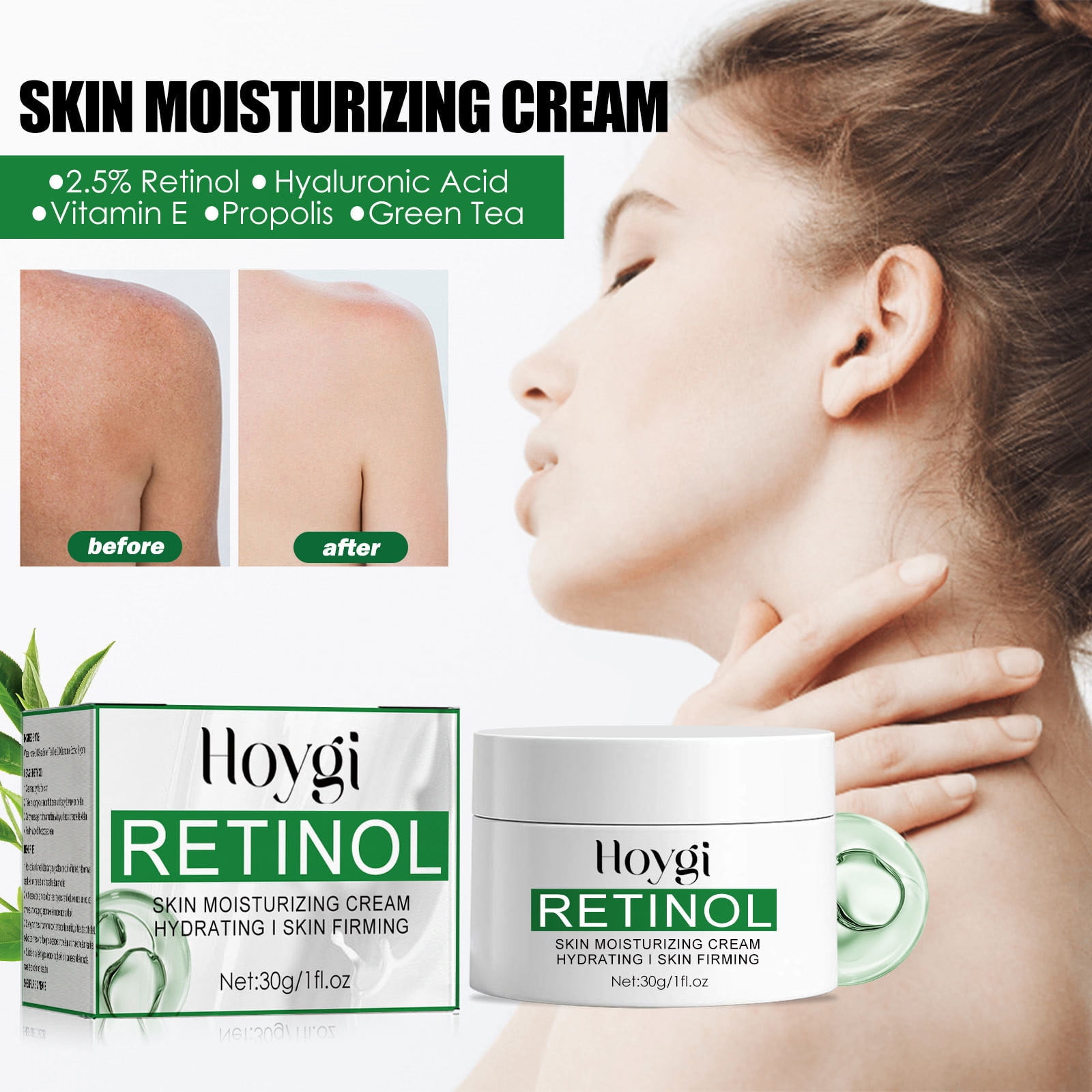 Discount Bonanza, Skin Brightening Cream Lighten Dark Spots Elbows ...