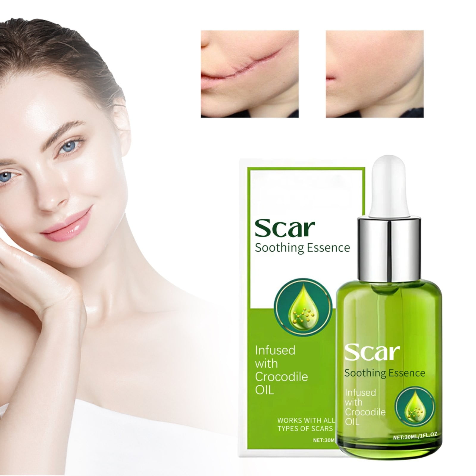 Djadtgl Scar Scar Mildly Moisturize And Fade Pregnancy Marks Fade Fine ...