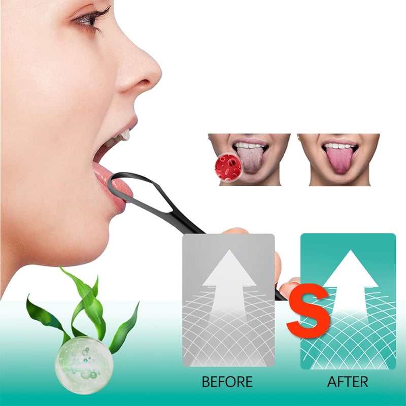 Double Sided Tongue Scraper Stainless Steel Oral Tongue Cleaner Brush ...