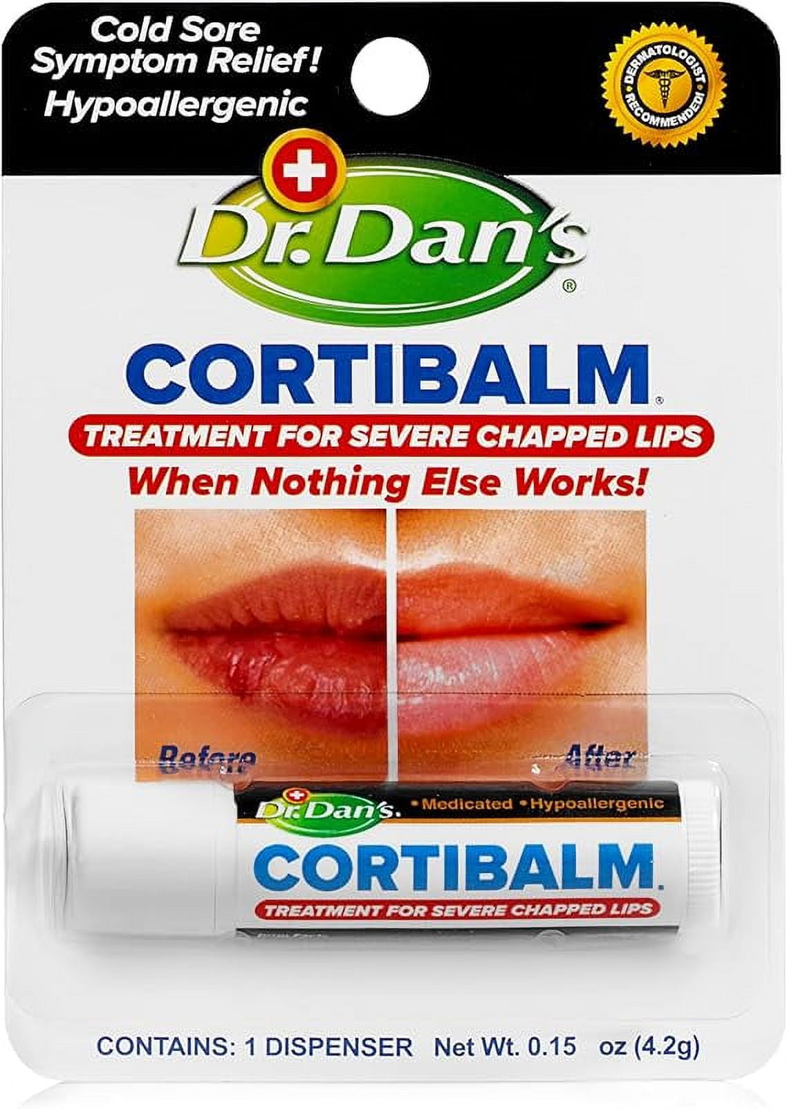 Dr. Dans Cortibalm Lip Balm for Chapped Lips - Great for Acne Patients ...