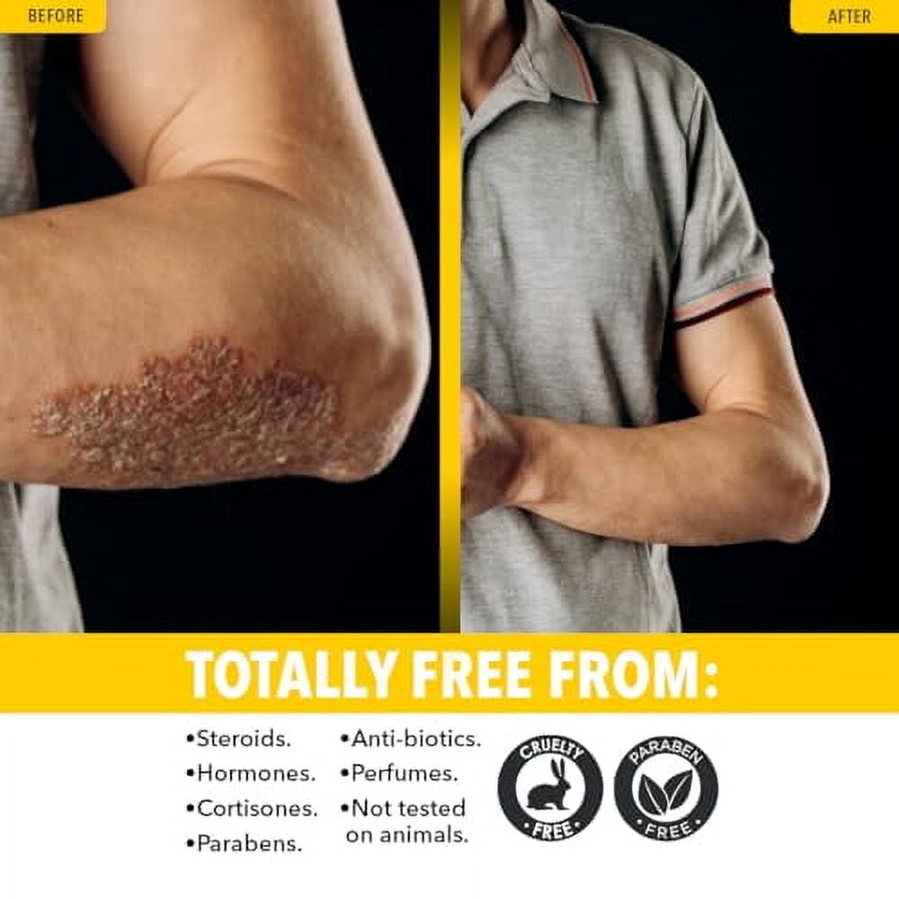 Dr. Robaina Sulfur Balancing Body Lotion - 3 Pack (Lotion for Dry ...