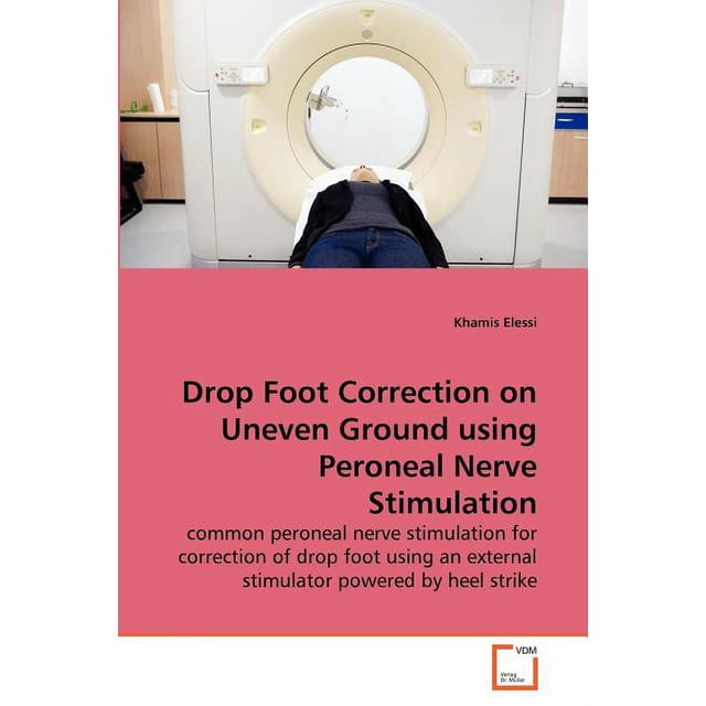 Drop Foot Correction on Uneven Ground using Peroneal Nerve Stimulation ...