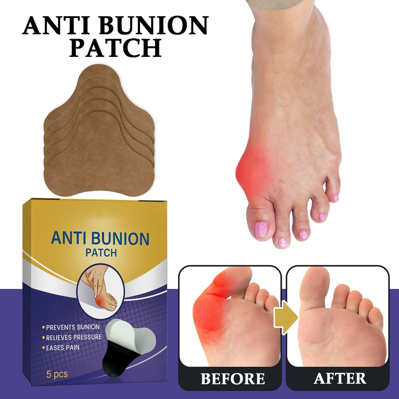 DssFDGR Bunion Patch Correction Foot Care Patch Thumb Valgus Swelling ...