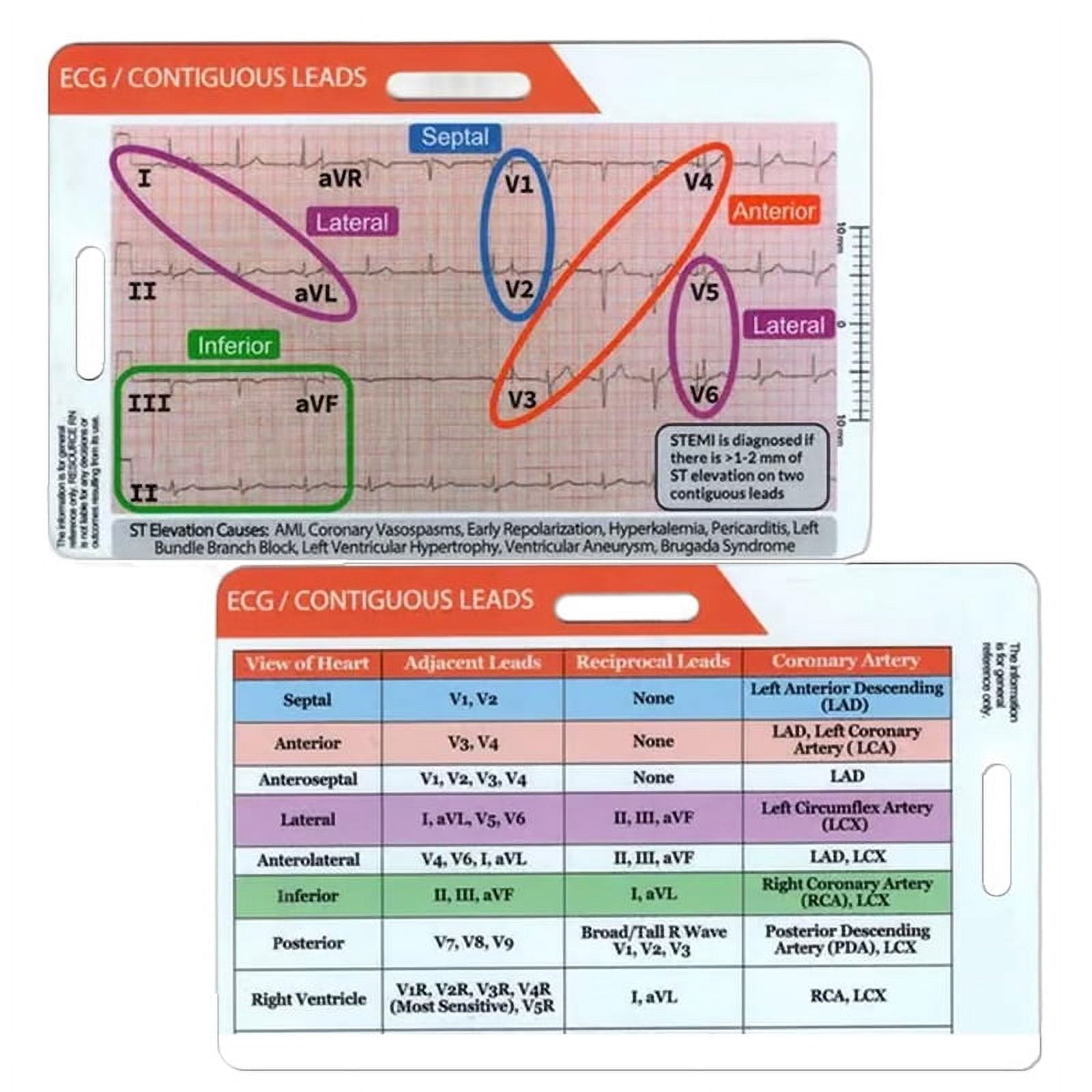 Duochuang ECG/EKG Rhythm Pocket Card Double Sided Design EKG Rhythm ...
