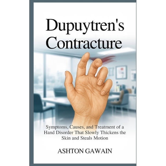 Dupuytren's Contracture: Symptoms, Causes, and Treatment of a Hand ...