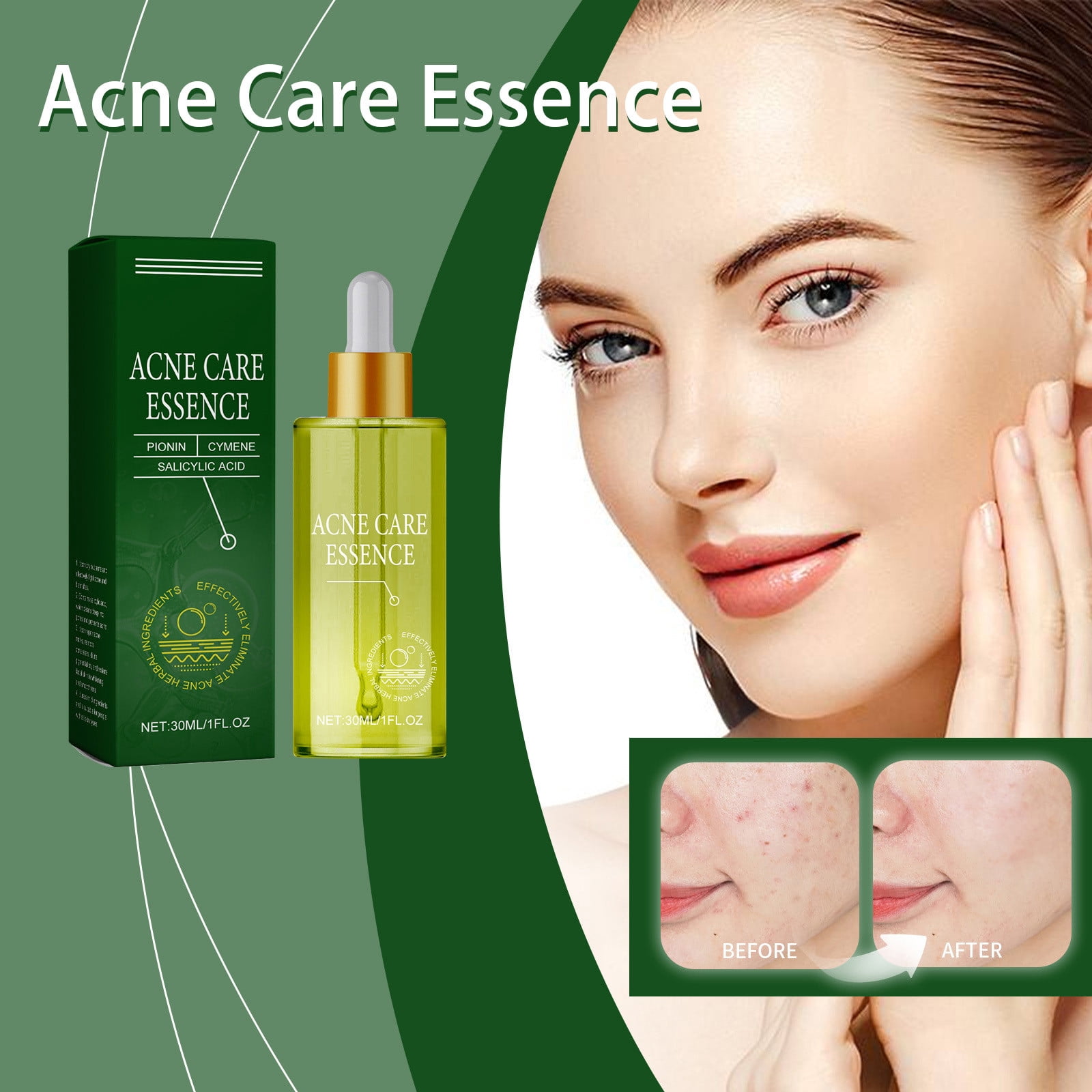 Dyue Acne Care Concentrate,Acne Clearing Concentrate,Gentle Acne ...