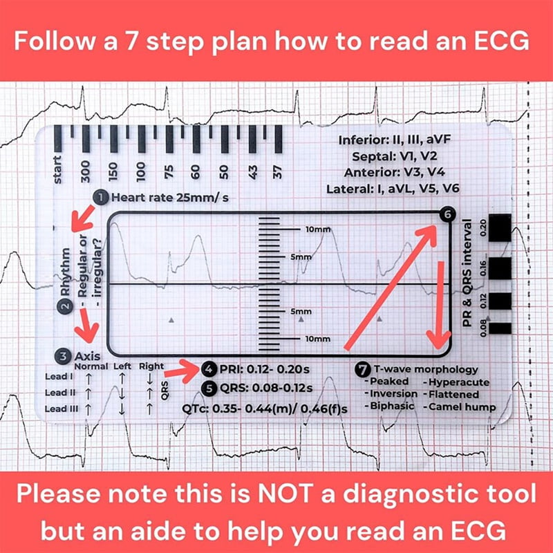 ECG 7 Step Ruler, ECG 7 Step Ruler for ECG/EKG Interpretation, Rapid ... ECG 7 Step Ruler, ECG 7 Step Ruler for ECG/EKG Interpretation, Rapid ...