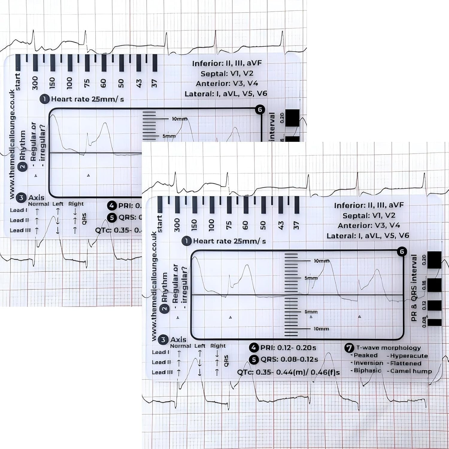 ECG 7 Step Ruler, ECG/EKG 7 Step Ruler Card for ECG/EKG Interpretation ...