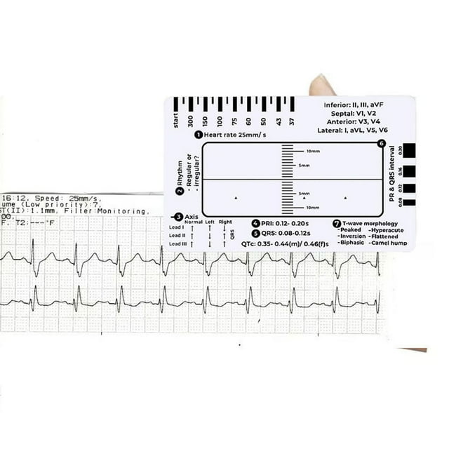 ECG 7 Step Ruler, ECG 7 Step Ruler for ECG/EKG Interpretation, ECG ... ECG 7 Step Ruler, ECG 7 Step Ruler for ECG/EKG Interpretation, ECG ...