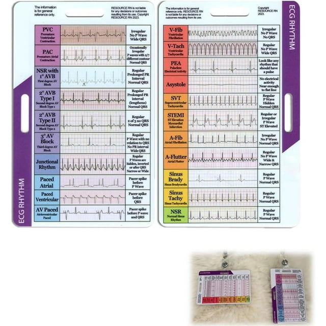 ECG/EKG Rhythm Pocket Card, Double Sided Design EKG Rhythm ...