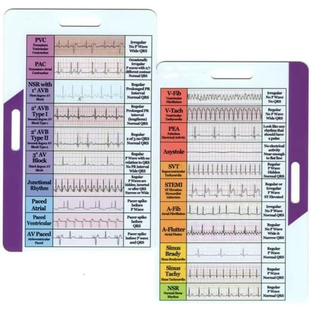 ECG/EKG Rhythm Pocket Card, ECG/EKG Rhythm Pocket Card, ECG Rate Pocket Cards, EKG Calipers ...