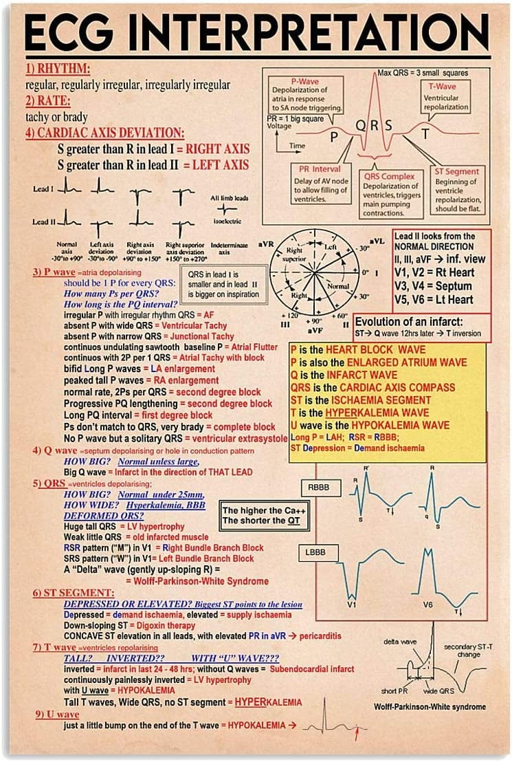 ECG Interpretation Metal Sign Doctor's Office Decor ECG Knowledge Retro ...