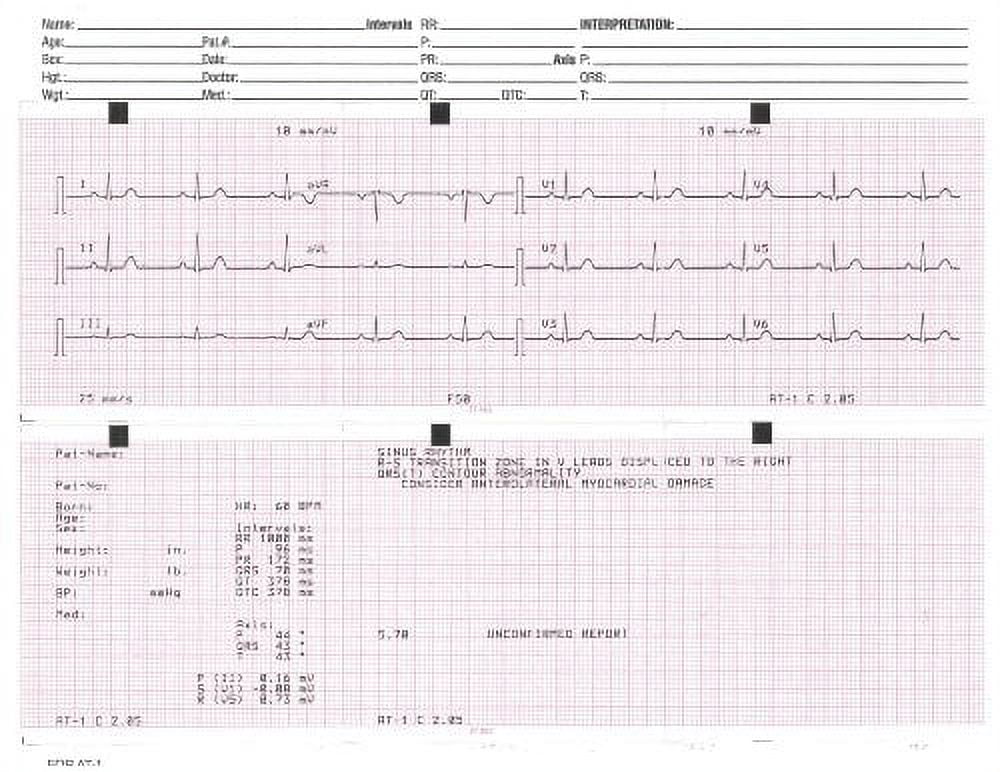ECG Mount for Welch Allyn / Schiller AT-1, 8-1/2" X 11" Landscape ...