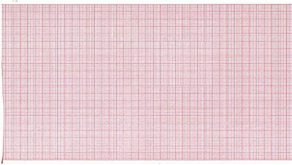 ECG Paper 112MM X 27M (Works for CARDICO 302, R112X27R, KENZ 103) (5 ...