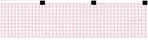ECG Paper Z-FOLD 60MM X 75MM X 250SHEETS (Works for 66010040, CARDIETTE ...