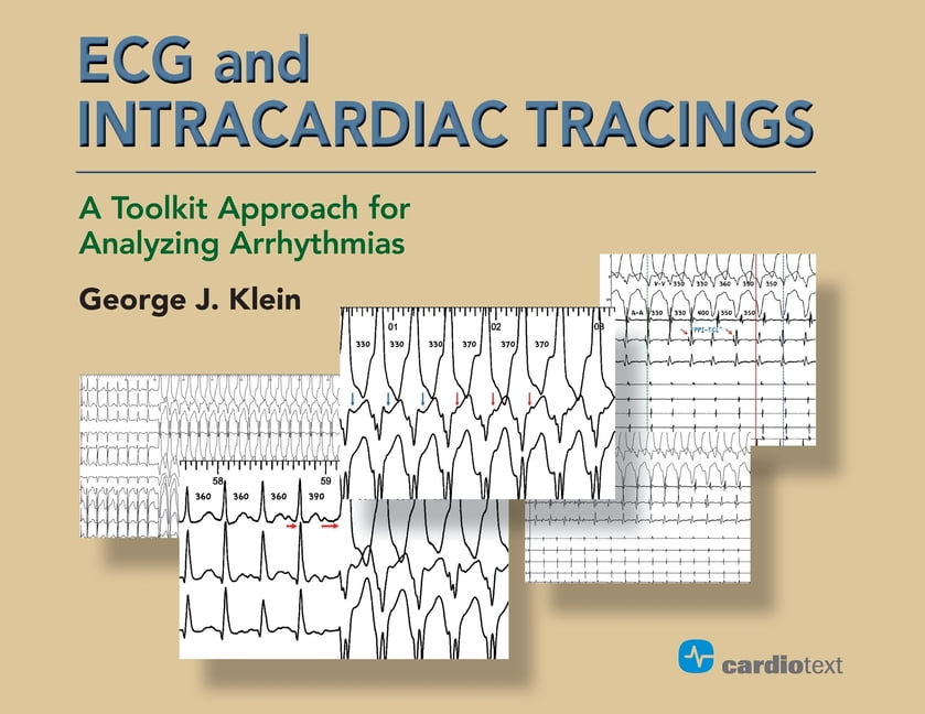 ECG and Intracardiac Tracings: A Toolkit Approach for Analyzing ...