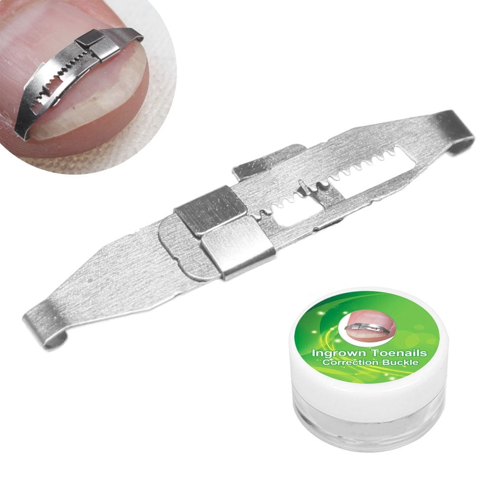 EECOO Paronychia Treatment Tool,Ingrowing Nail Corrector,Stainless ...