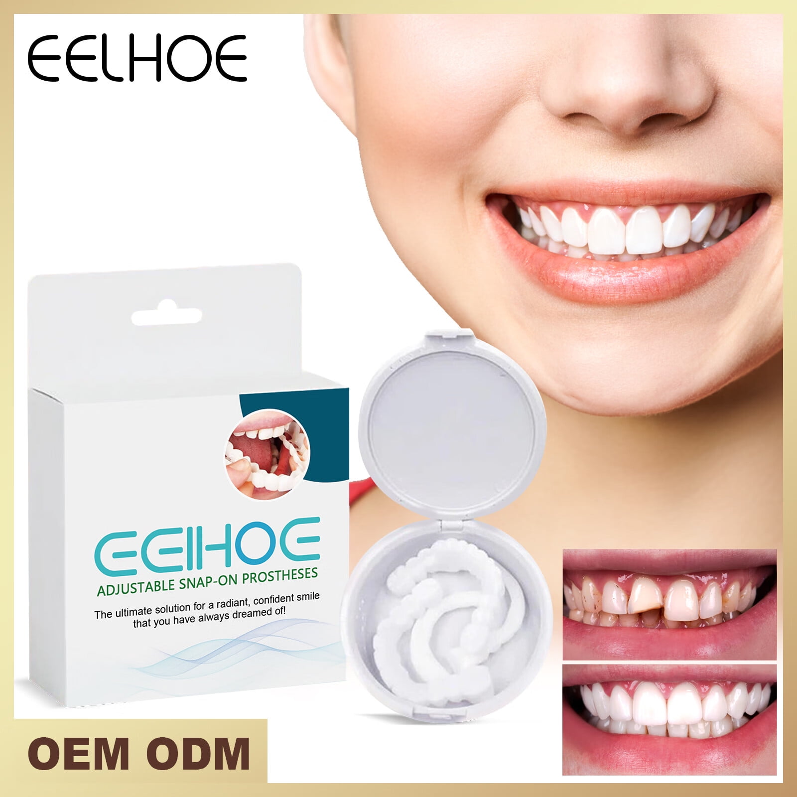 EELHOE Adjustable Snap-On Dentures Grooming Teeth Gaps Fillings Braces ...
