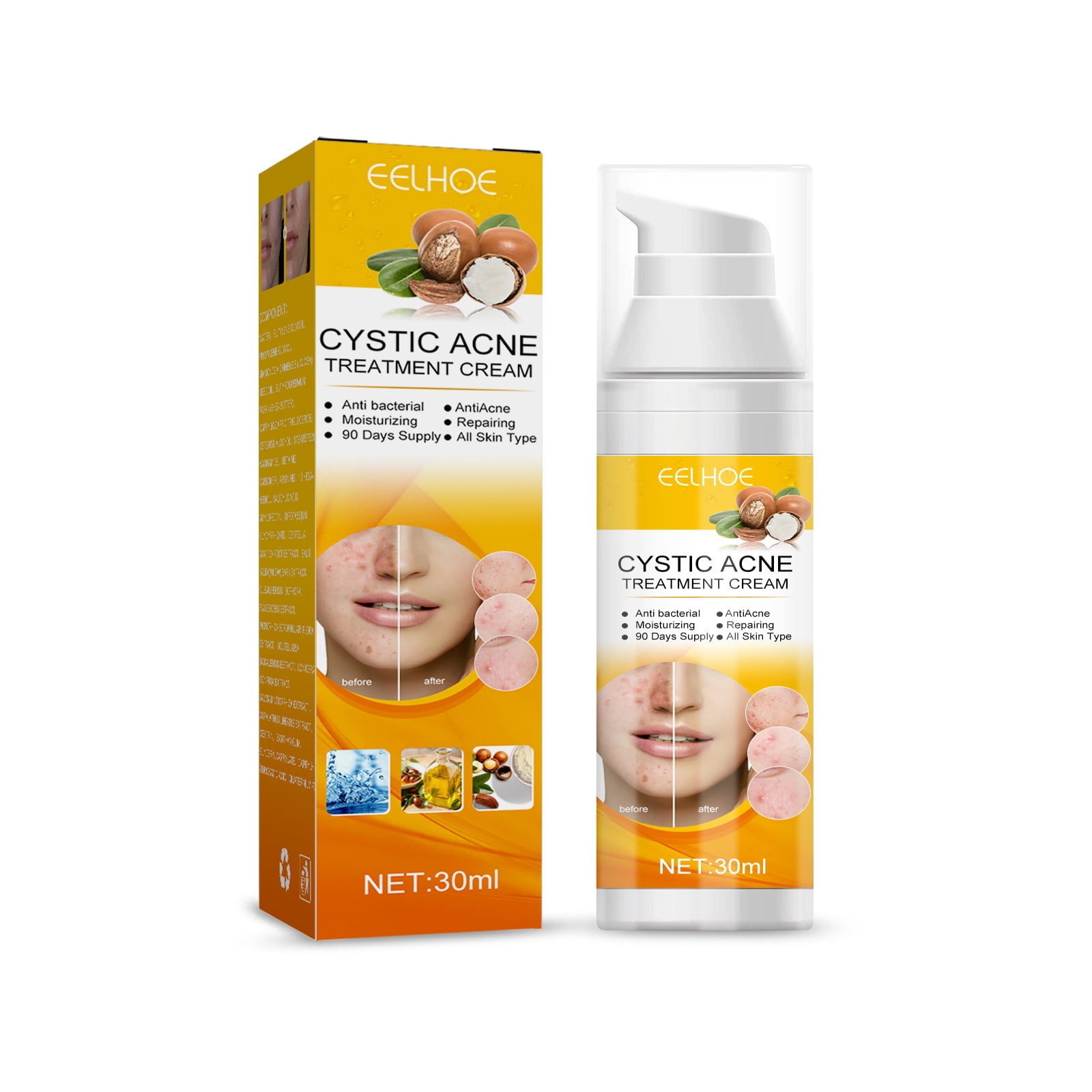 Eelhoe Cystic Hormonal And Severe Acne Treatment Cream For Adolescent