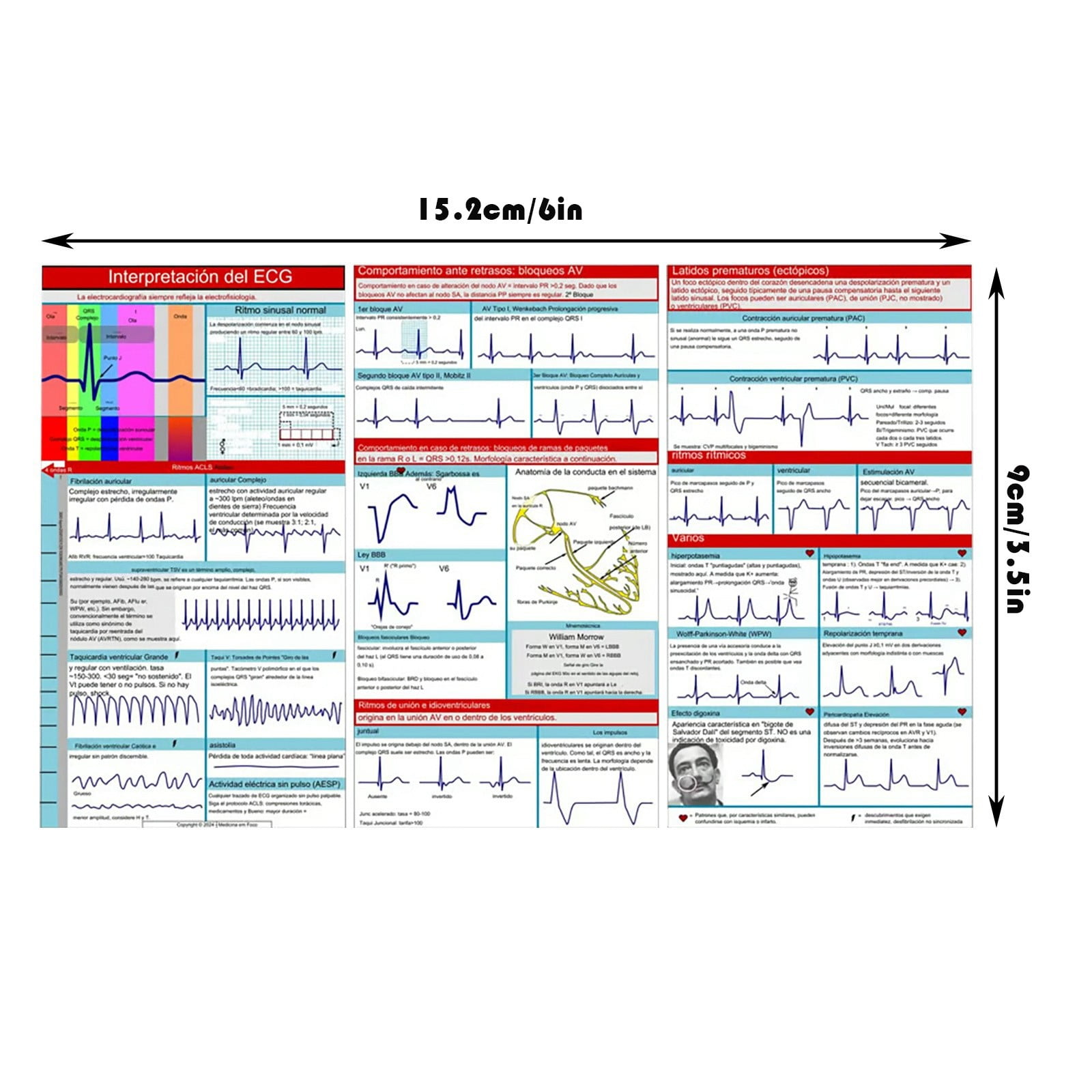 EKG Pocket Guide, EKG Rhythm Interpretation, Compact & Portable Reference Card, Rapid ...
