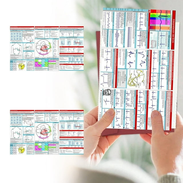 EKG Pocket Guide, EKG Rhythm Interpretation,Double Sided Compact Portable Reference Card, Rapid ...