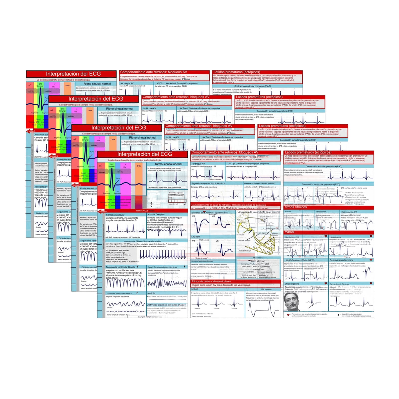 EKG Pocket Guide, EKG Rhythm Interpretation,Double Sided Compact ...