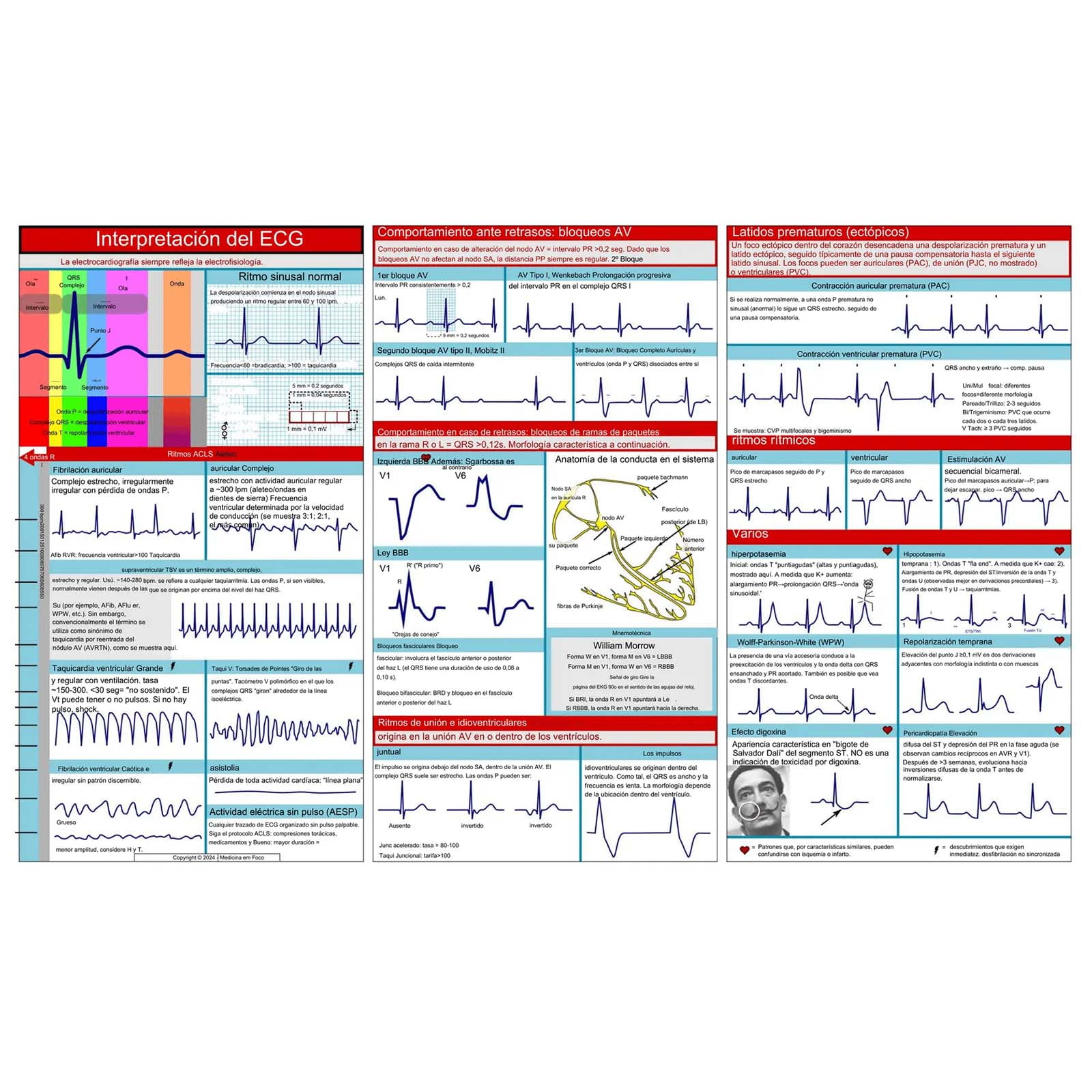 EKG Pocket Guide, EKG Rhythm Interpretation,Double Sided Compact ...