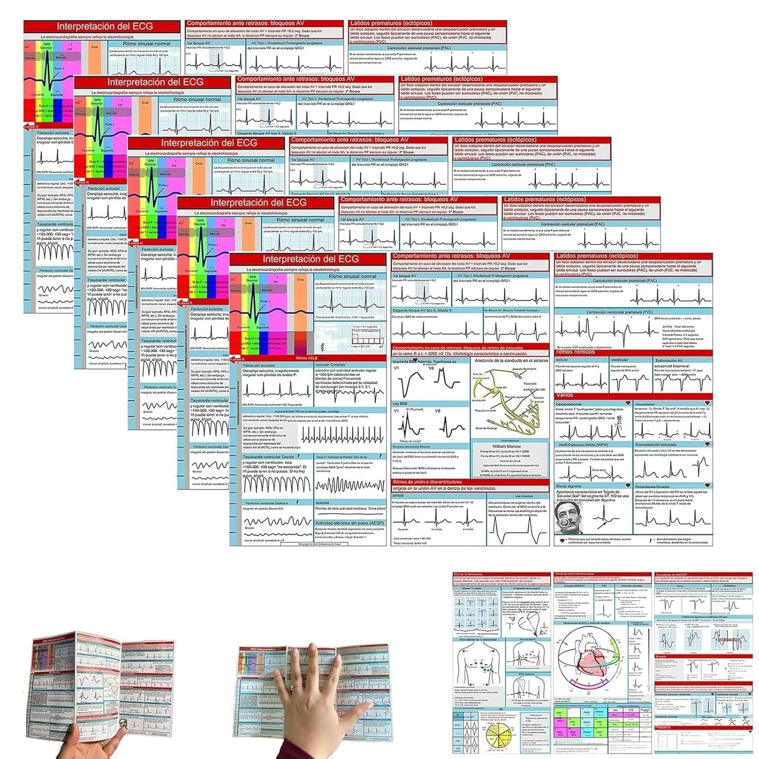 EKG Pocket Guide, EKG Rhythm Interpretation, Great Study Guide for EKG ...