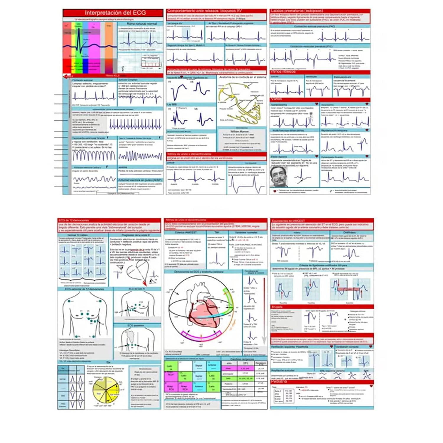 EKG Pocket Guide, EKG Rhythm Interpretation, Rapid Interpretation Guide ...