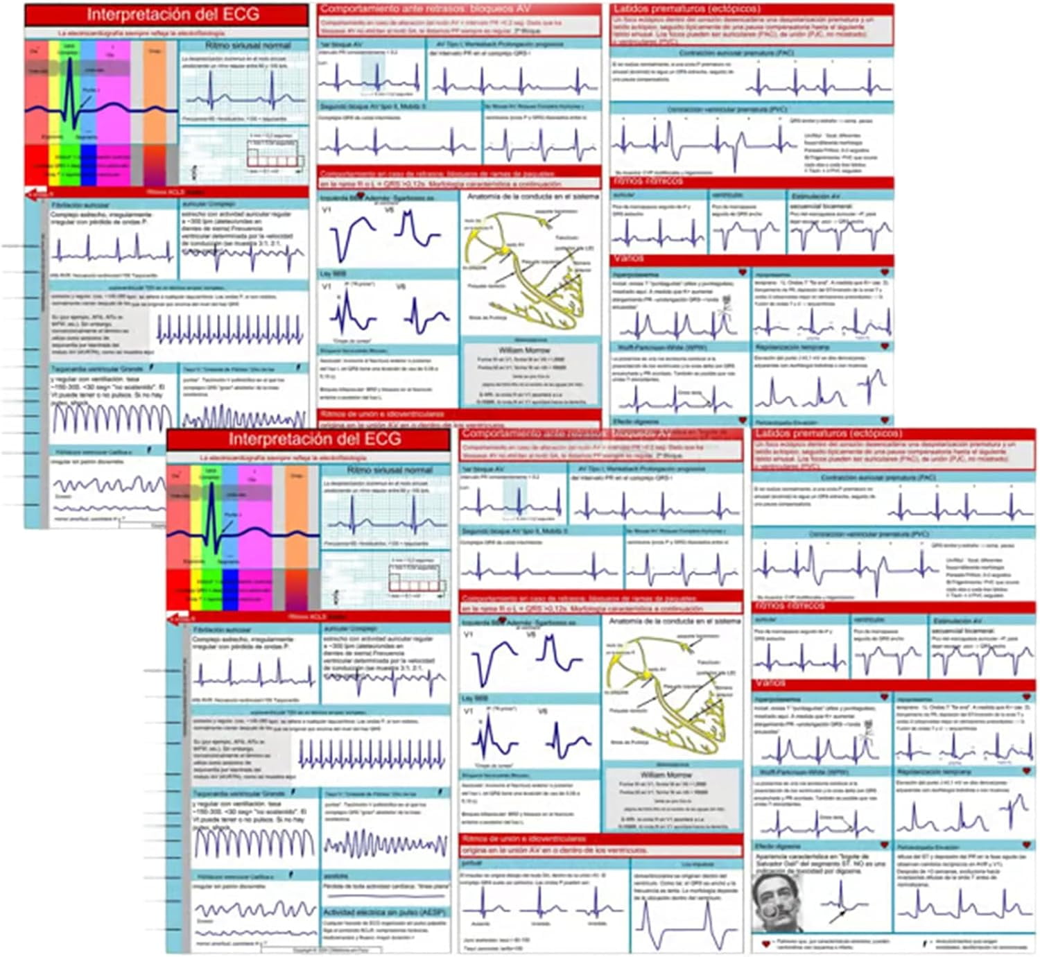 EKG Pocket Guide, EKG Rhythm Pocket Card, Double-Sided Tri-fold ...