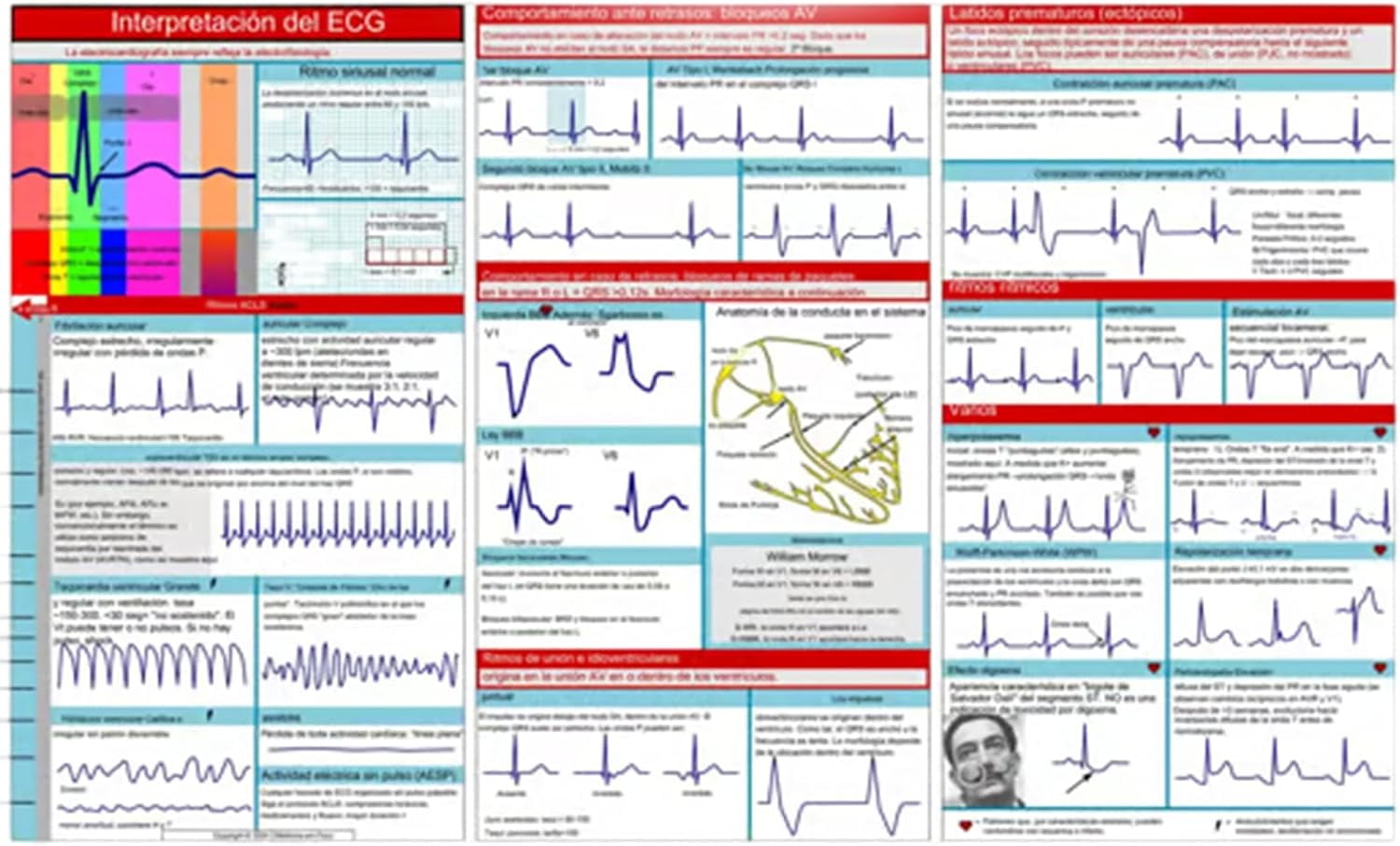 EKG Pocket Guide, EKG Rhythm Pocket Card, Double-Sided Tri-fold ...