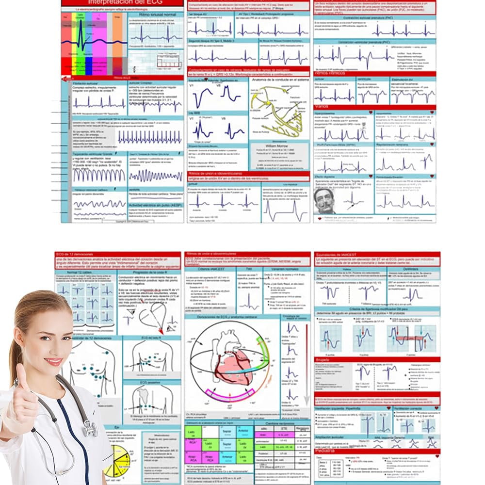 EKG Pocket Guide, EKG Rhythm Rapid Interpretation Guide, 12 Lead ECG ...