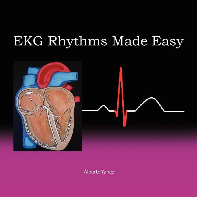 EKG Rhythms Made Easy (Paperback) - Walmart.com