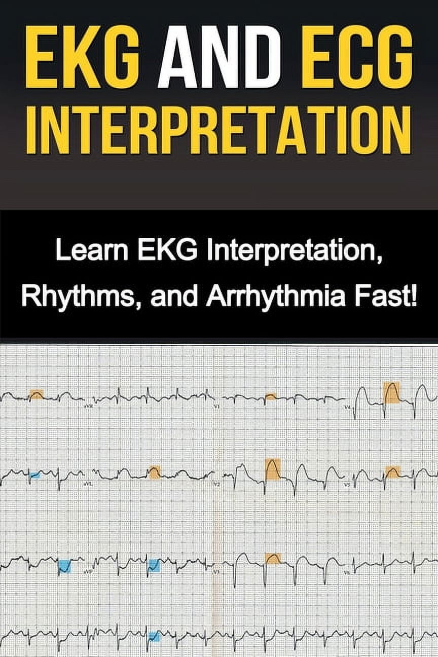 EKG and ECG Interpretation: Learn EKG Interpretation, Rhythms, and ...