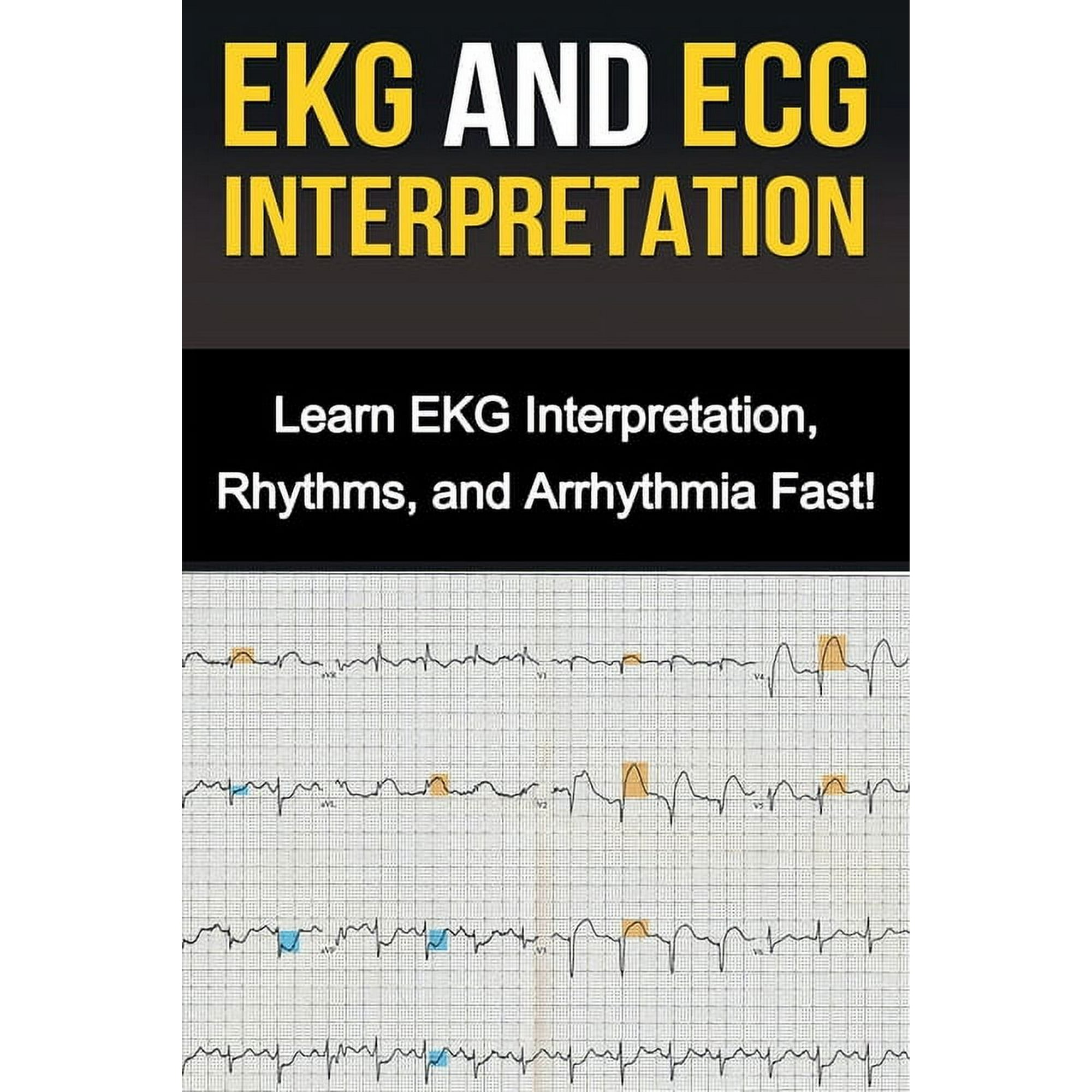 Ecg Interpretation