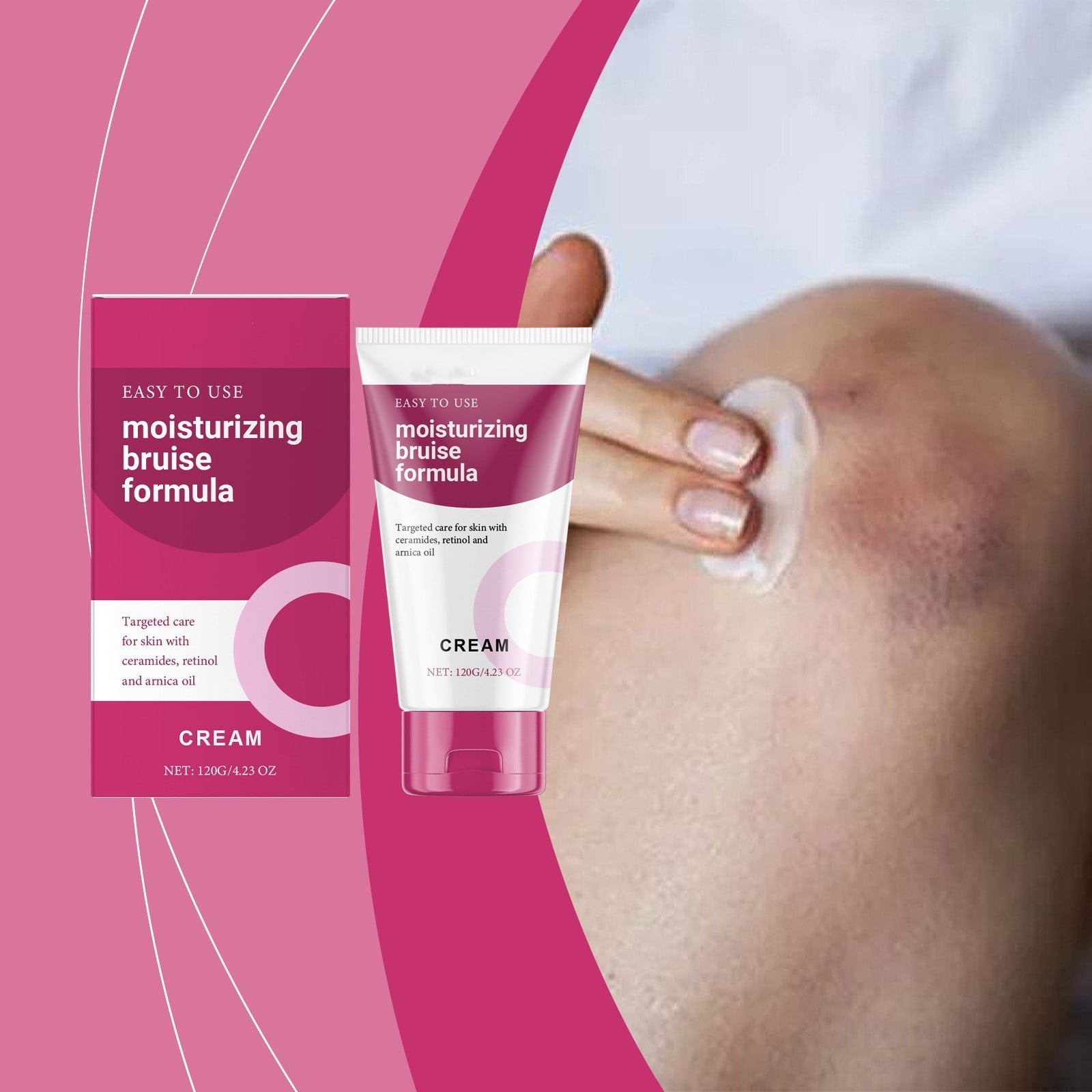 ETCONEN Bruise Cream - Moisturizer for Bruising on Arms, Legs & Hands ...
