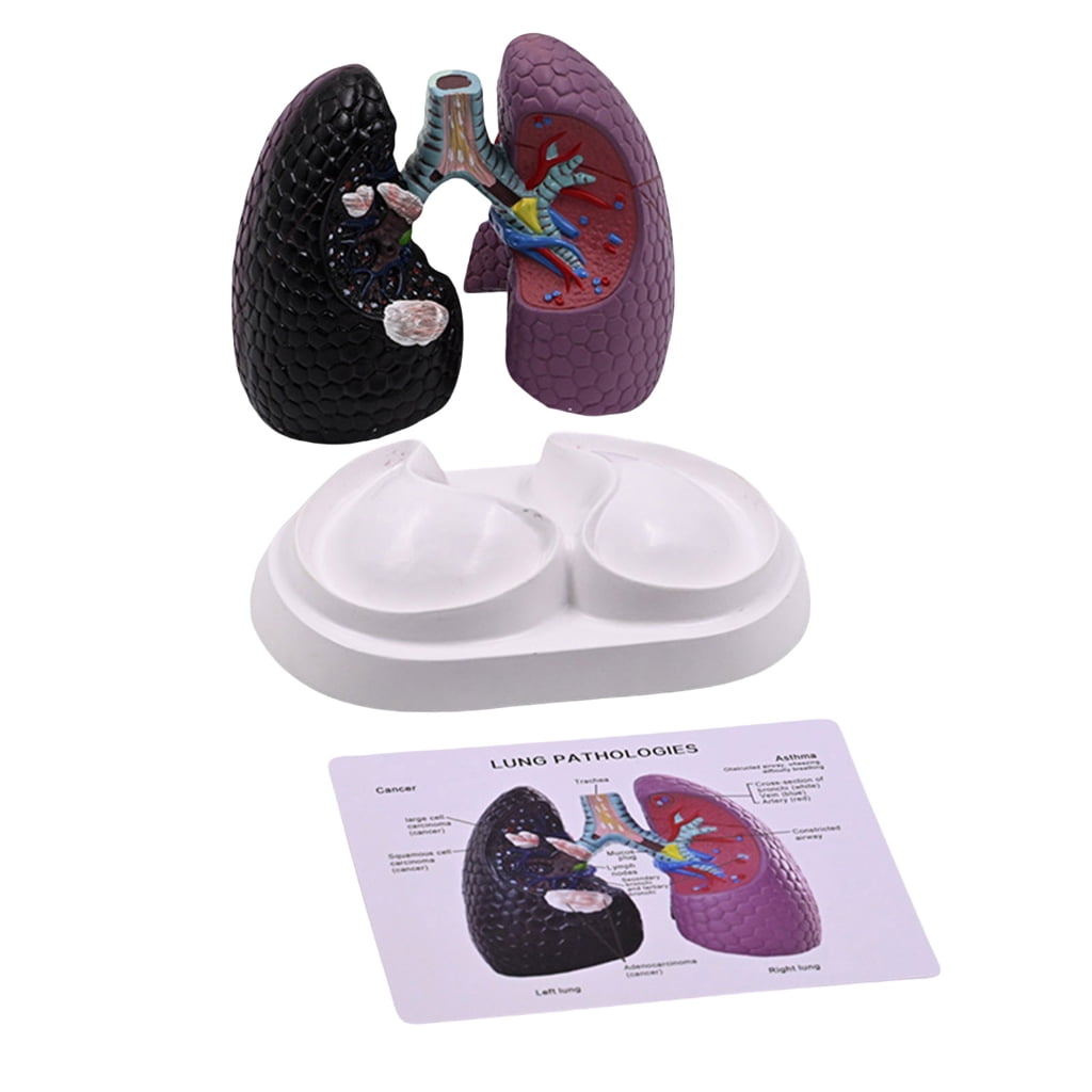 EXCIXING Pathological Lung Anatomy Model Human Anatomical Lung Model ...