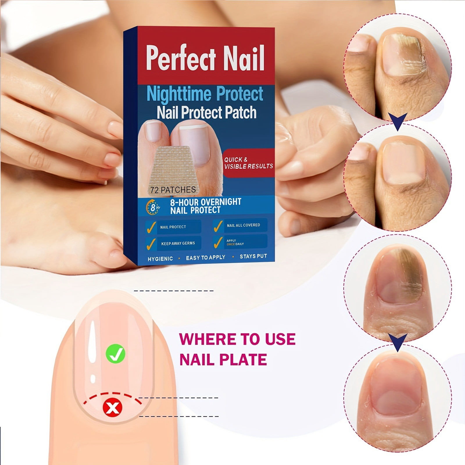 EZieo Perfect Nail, Nighttime Nail Protect, Night Renewal Fungal Nail ...