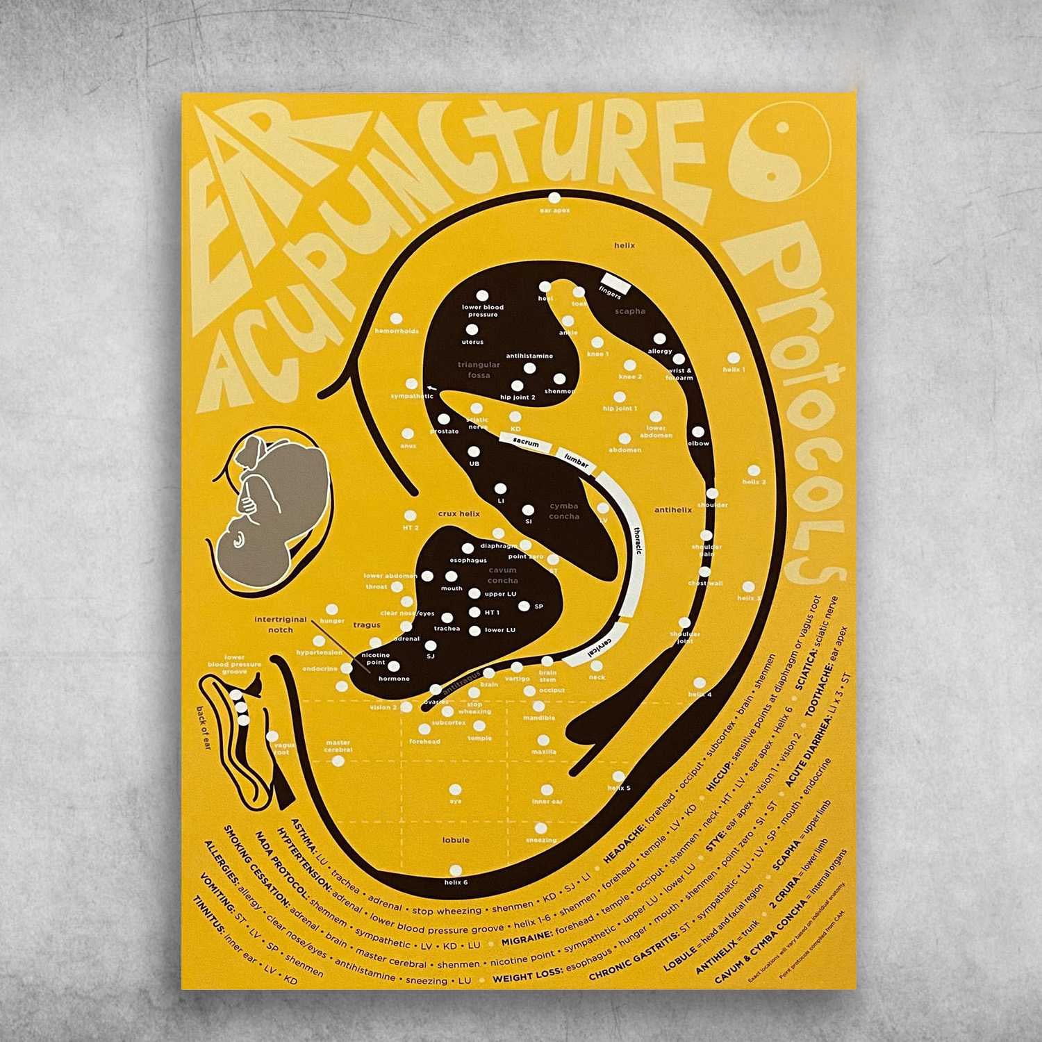 Ear Acupuncture Protocols, Ear Poster, Ear Knowledge 11 x 17 Inch ...