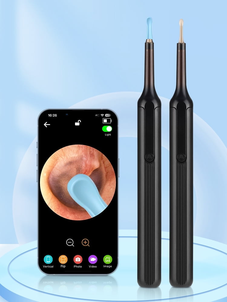 Ear Camera and Wax Remover，Ear Wax Removal Tool，Ear Cleaner with 30W HD ...